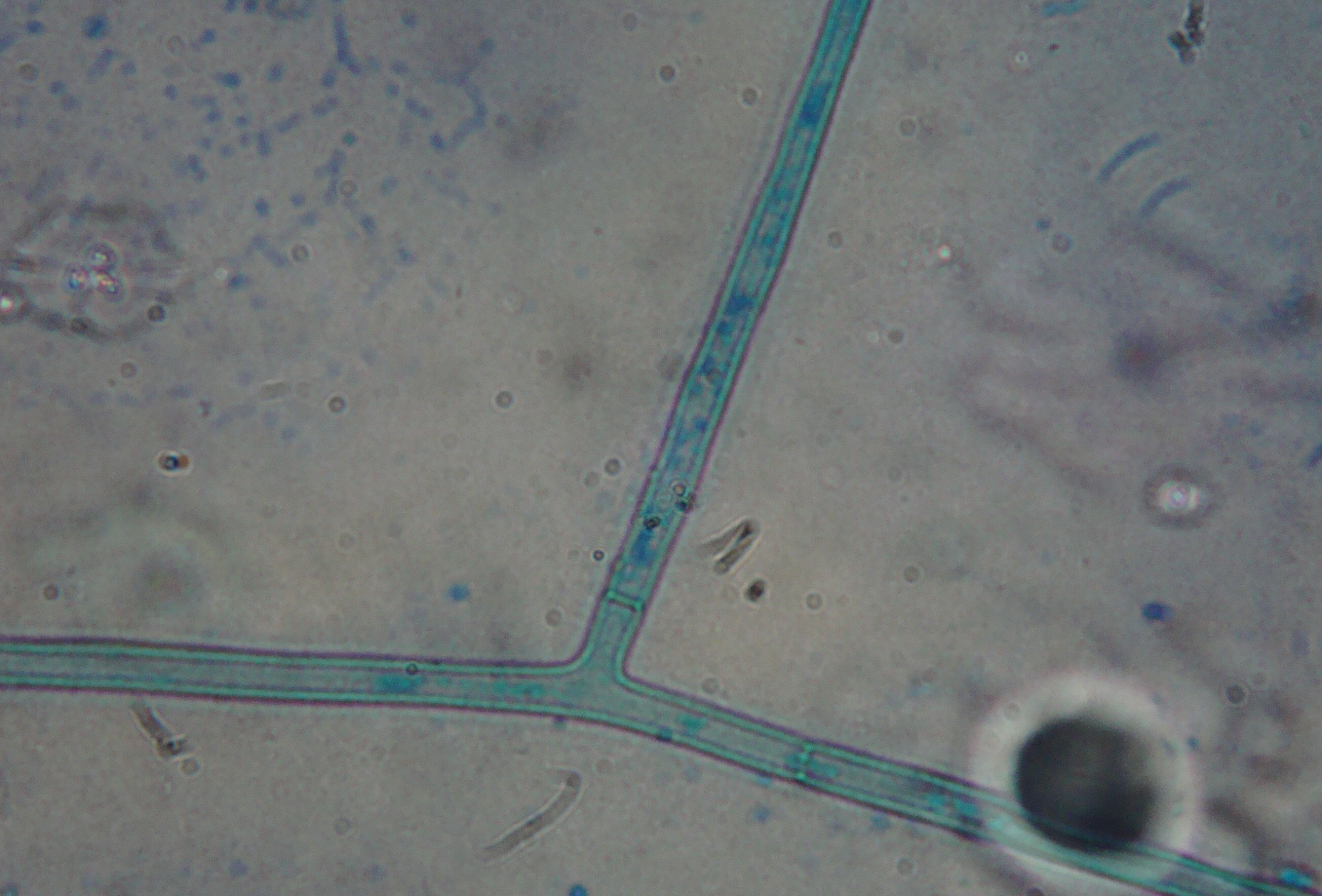 Rhizoctonia spp | Prevenção, controle e danos